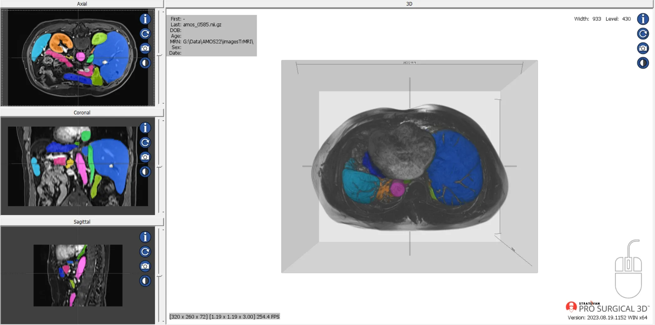 Enhancing Data Analysis: Exploring the Versatility of Segmentation for ...